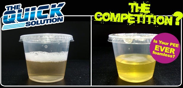 Synthetic Urine Kit Park Village Canton GA | High Level Health